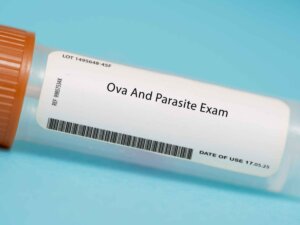 Parasite Ova and Parasite Test Labs | IBS Gut Health Clinic