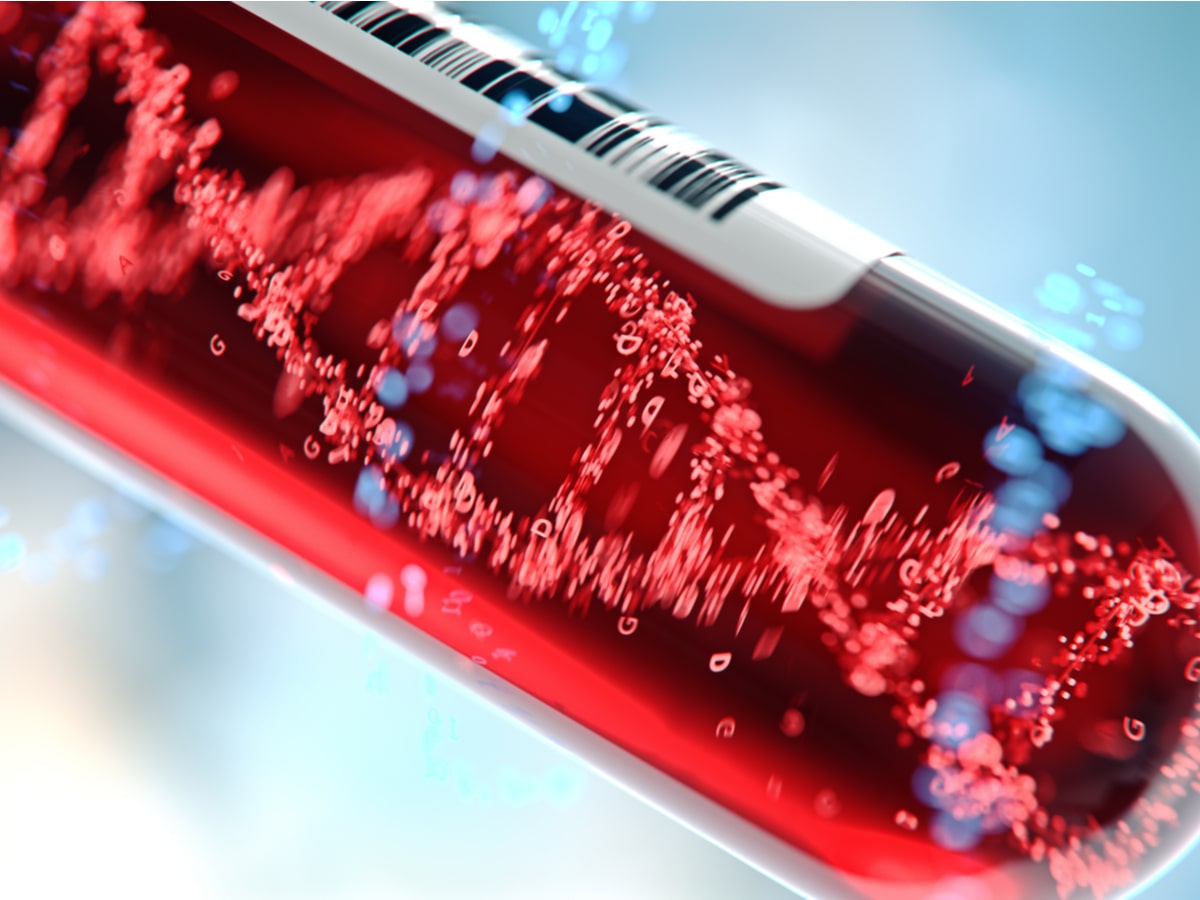 Candida Test: What You Need To Know About Candidasis Testing