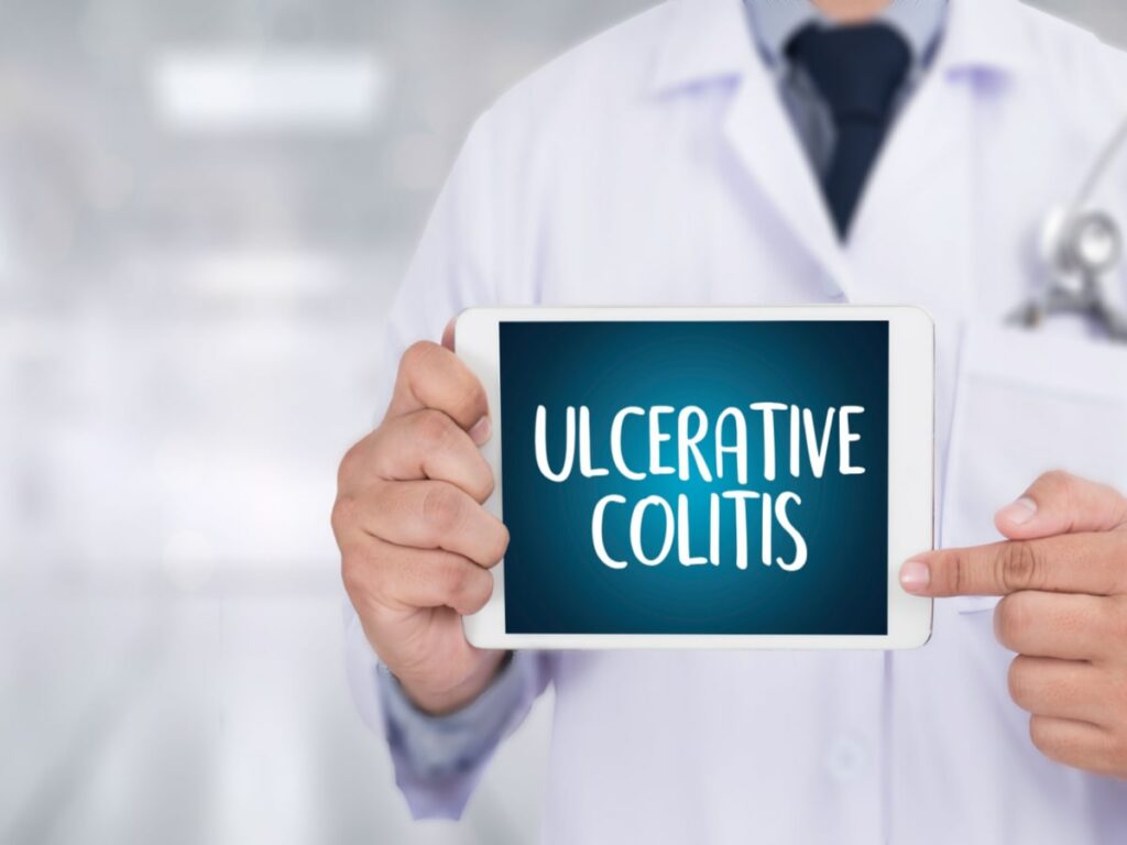 How is Ulcerative Colitis Diagnosed? | The IBS & Gut Health Clinic